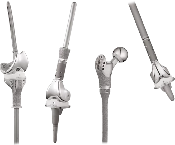 Pixee Medical | United Orthopedic France